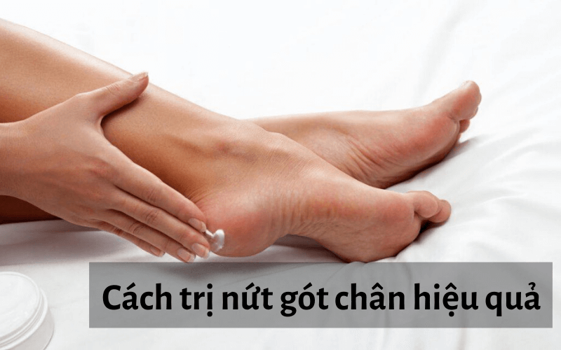 Cách trị nứt gót chân hiệu quả tại nhà - Bí quyết đẹp khỏe